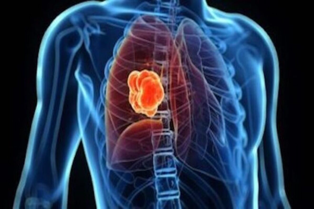 7 Simple Breathing Exercises to Strengthen Your Lungs - HealthySoch